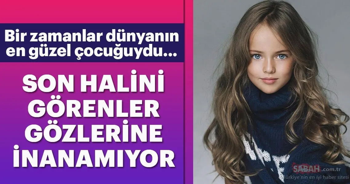 Bir zamanlar dünyanın en güzel çocuğuydu! Şimdiki hali şaşırtıyor ... Bir zamanlar dünyanın en güzel çocuğuydu! Şimdiki hali şaşırtıyor ...