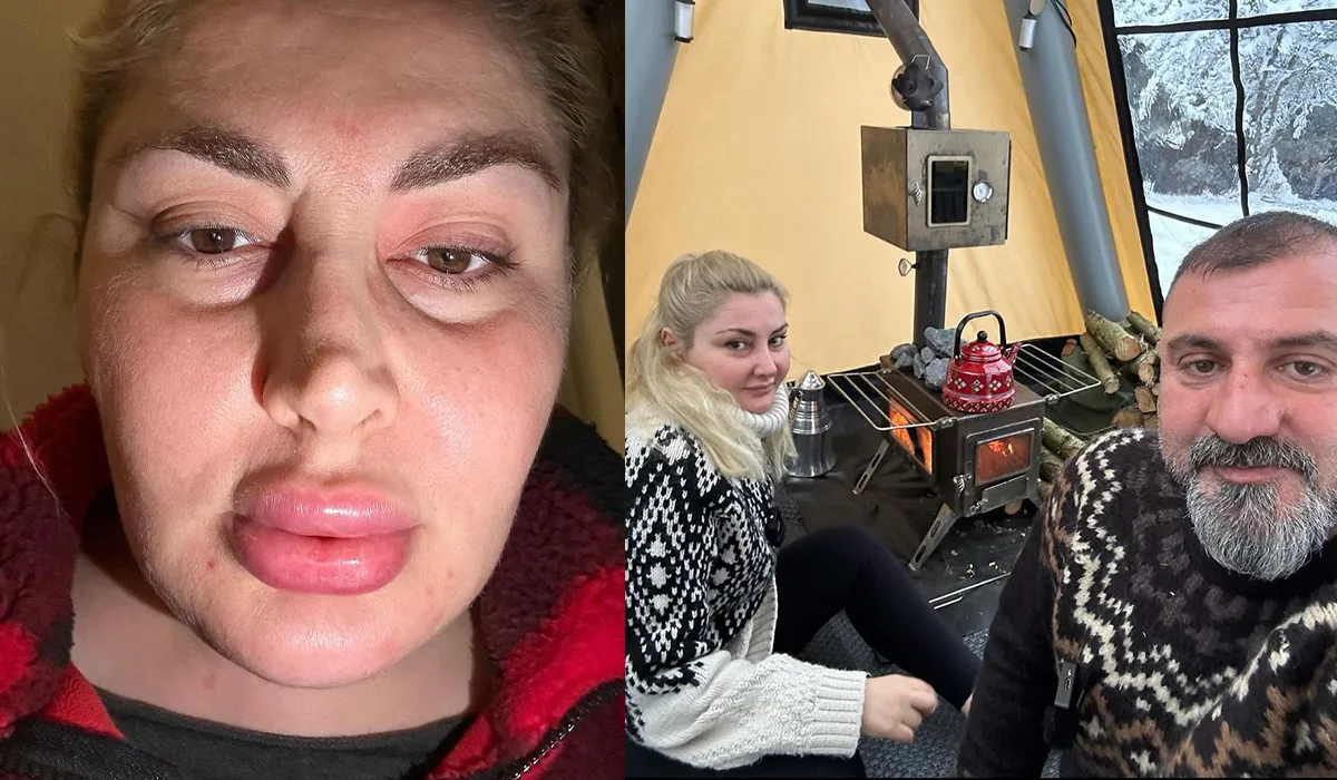 Atik Ailesi’nden Burcu Atik hastalığını açıkladı: En son kampta ...