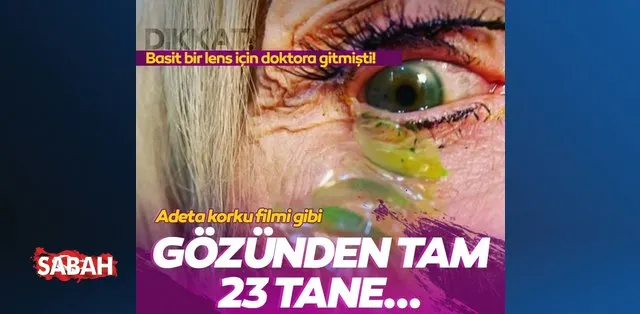 Adeta Korku Filmi Gibi Basit Bir “lens” Için Gitti Gözünden Tam 23