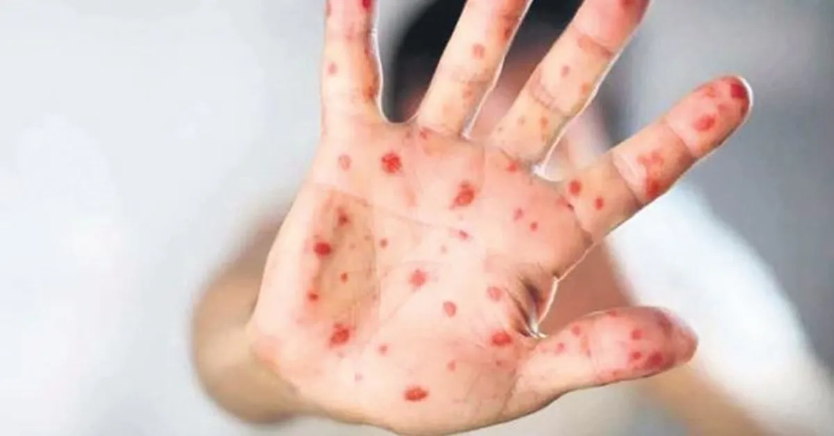 Yeni salgın alarmı: Domates gribi - Son Dakika Haberler